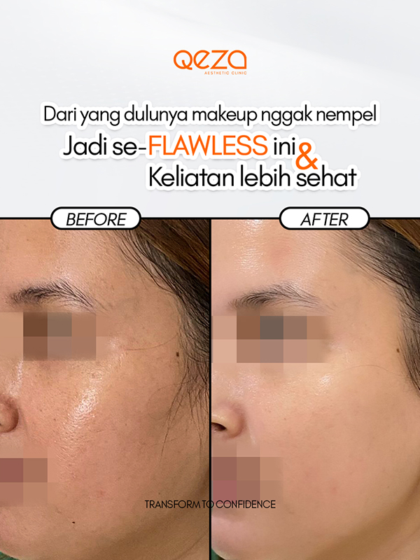Glass Skin Booster